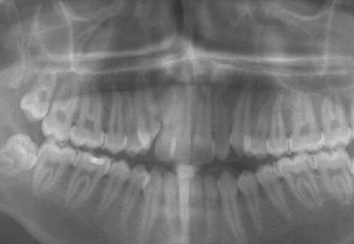 Smart Dental Teleradiology